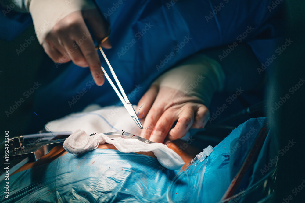 Photo Stock Team of surgeons in operating room. Needle holder or a ...