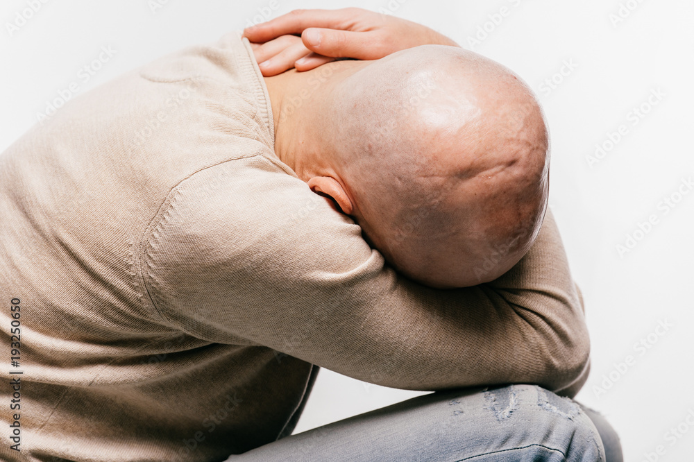 Foto de Stock Bald man psychological stress struggling for life arter ...
