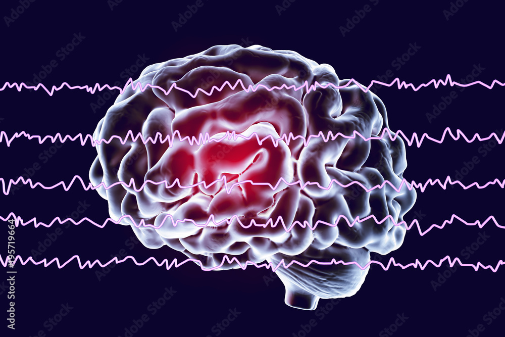 EEG Electroencephalogram, brain wave in awake state with mental ...