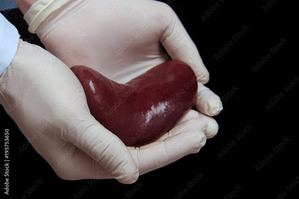Real Human Kidney Transplant
