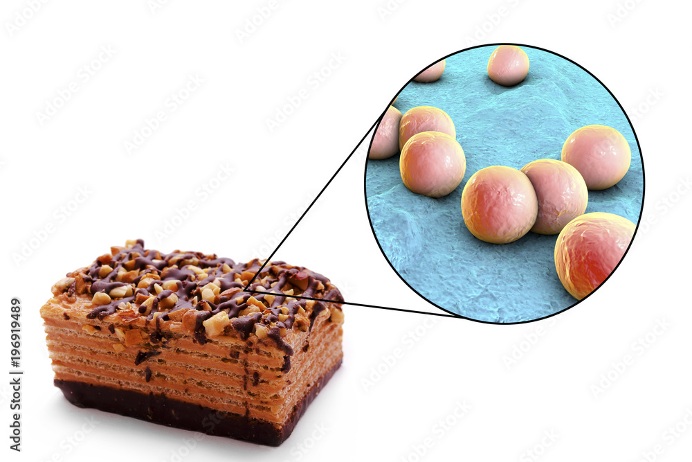 Staphylococcal food poisoning, medical concept, 3D illustration showing ...