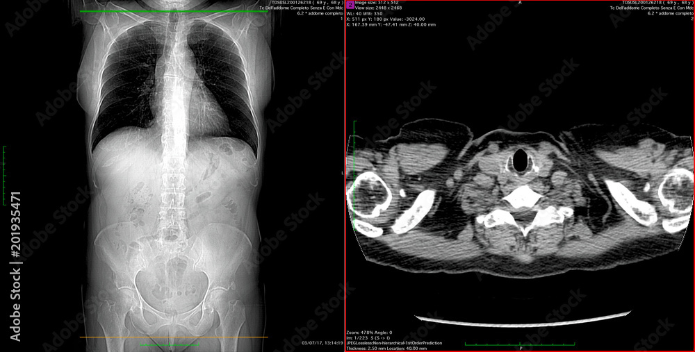 CT scan of women's abdomen Stock Photo | Adobe Stock