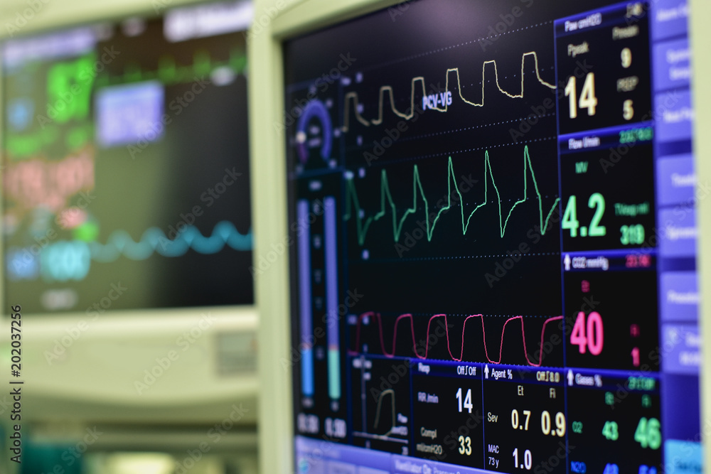 EKG monitor in intra aortic balloon pump machine in icu on blur ...