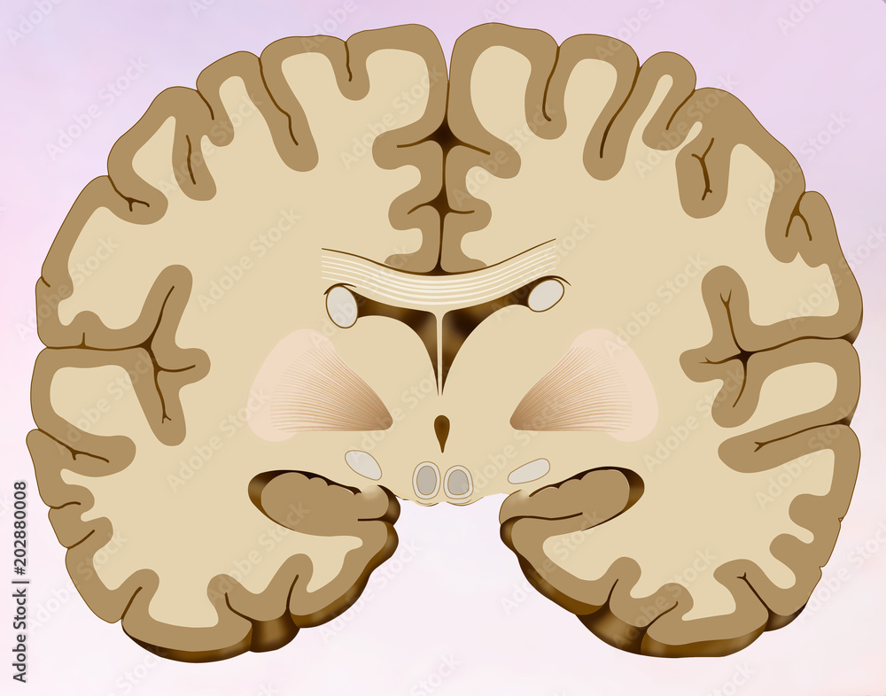 Ilustración de Stock Corte coronal del cerebro humano en la cual ...