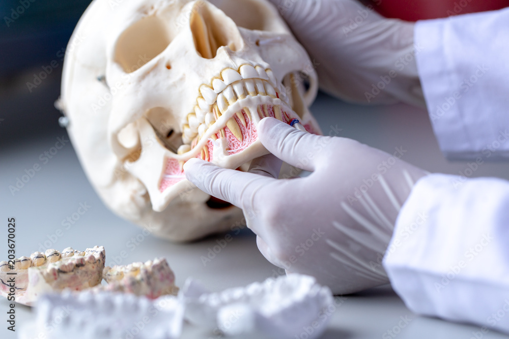 Study cast of Diagnostic cast and dental gypsum models in dental ...