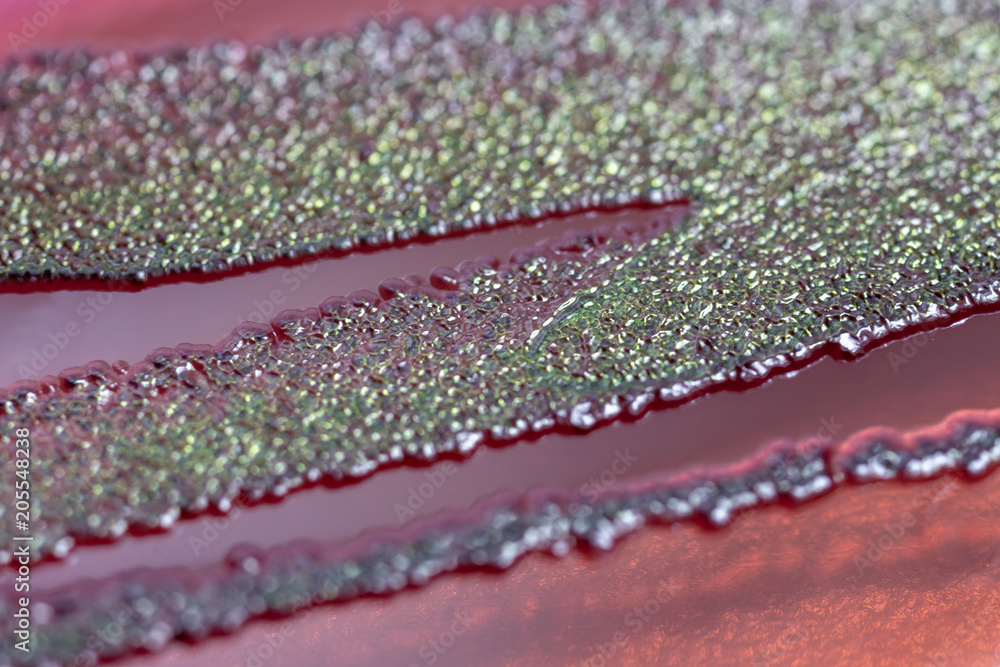 Colony Characteristics of Escherichia coli (E. coli) is a Gram-negative ...