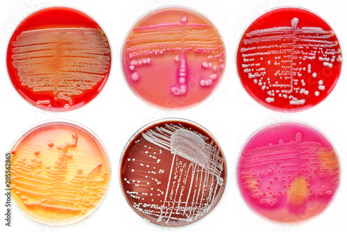 Mixed of bacteria colonies in petri dish, blood agar, chocolate agar ...