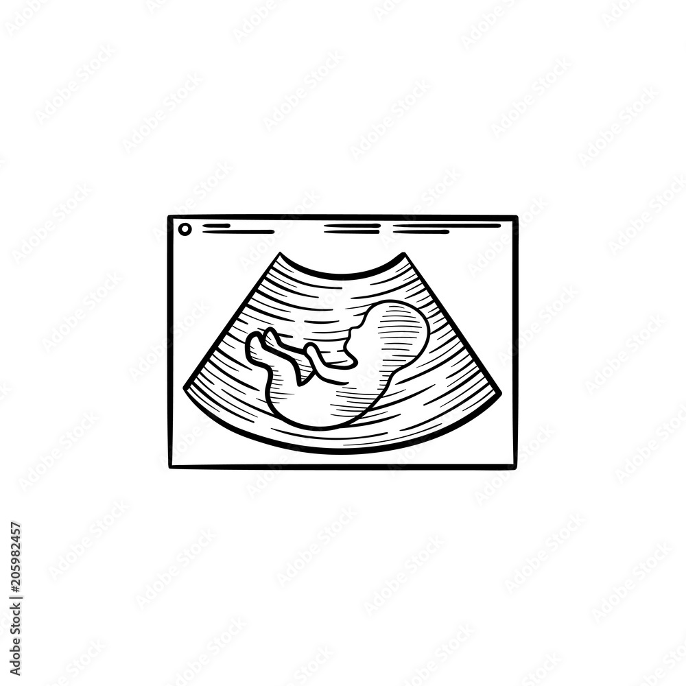 Fetal ultrasound hand drawn outline doodle icon. Pregnancy sonogram of ...