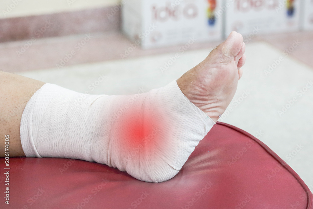Foot pain, female heel intertwined with a cloth with red spots on chair ...