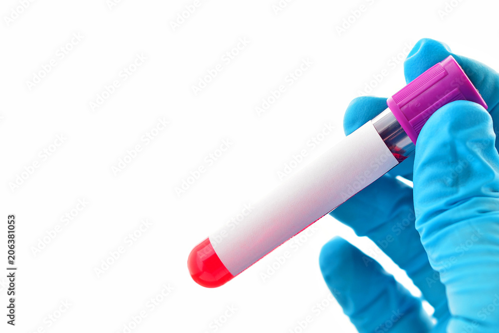 Purple cap tube with blood sample for laboratory testing, white ...