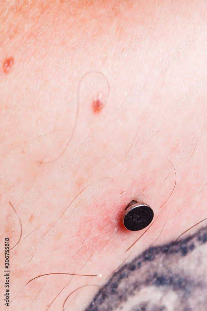 Sternum, cleavage, microdermal, surface piercing on collarbones. Stock ...