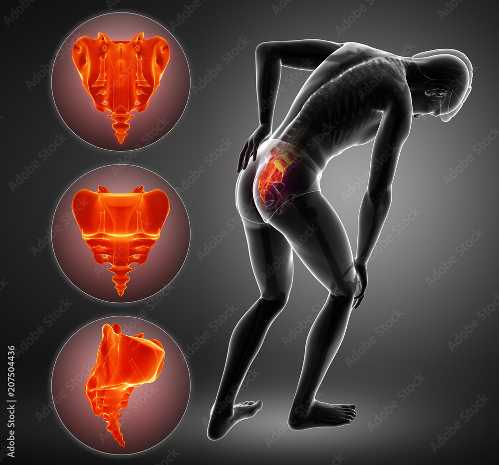 3d illustration of sacrum bone pain Stock Illustration | Adobe Stock