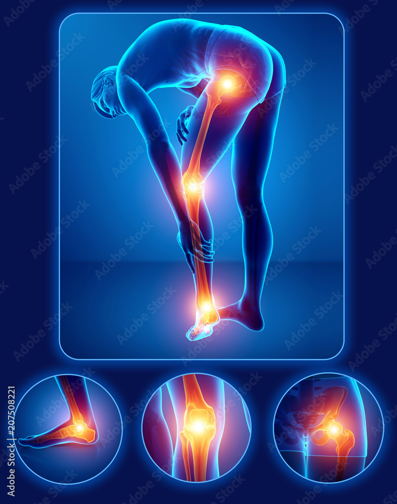 3d Illustration of male feeling Leg pain Stock Photo | Adobe Stock