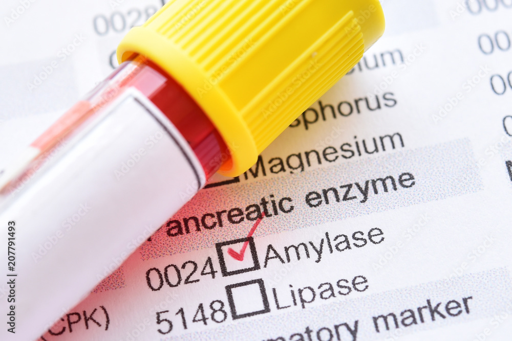 Blood sample tube with laboratory requisition form for amylase enzyme ...