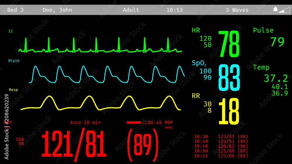 Monitoring of patient's condition, vital signs on ICU monitor in ...