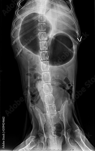 X-ray of dog anterior view with Gastric dilatation volvulus “GDV” or ...