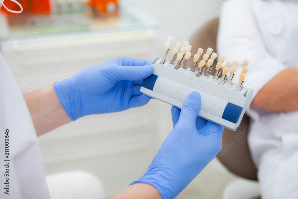 palette for the color of teeth, color matching, choice of denture color ...