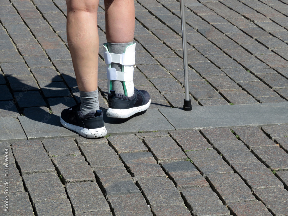 Fotografie Female feet with the splint, orthosis for leg. Person with ...