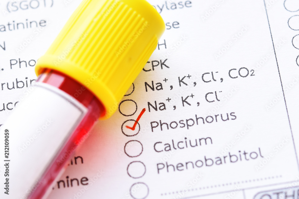 Blood sample tube with laboratory requisition form for phosphorus test ...