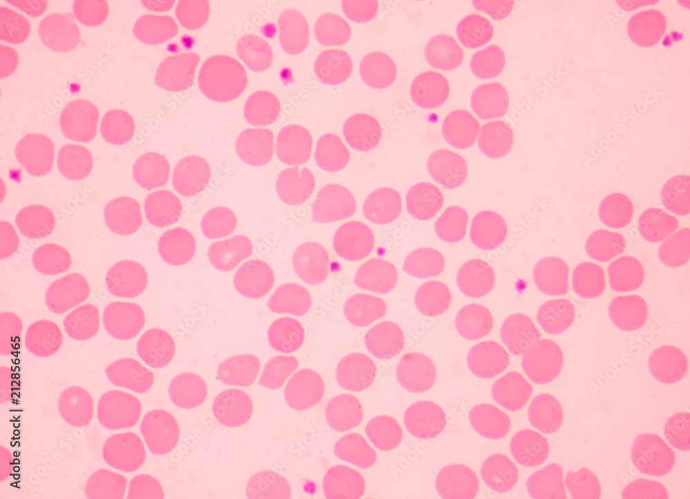 Normochromic nomocytic red blood cells. Stock Photo | Adobe Stock