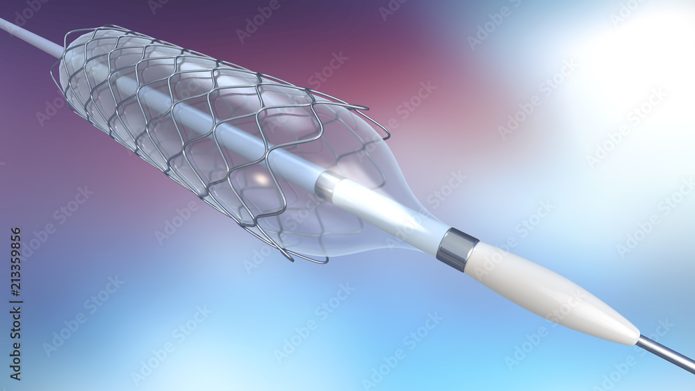3d illustration of catheter for stent implantation for supporting blood ...