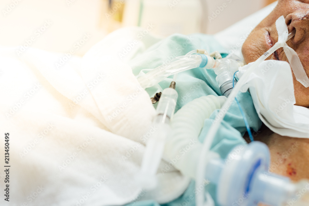 Patient do tracheostomy and ventilator in hospital Stock Photo | Adobe ...