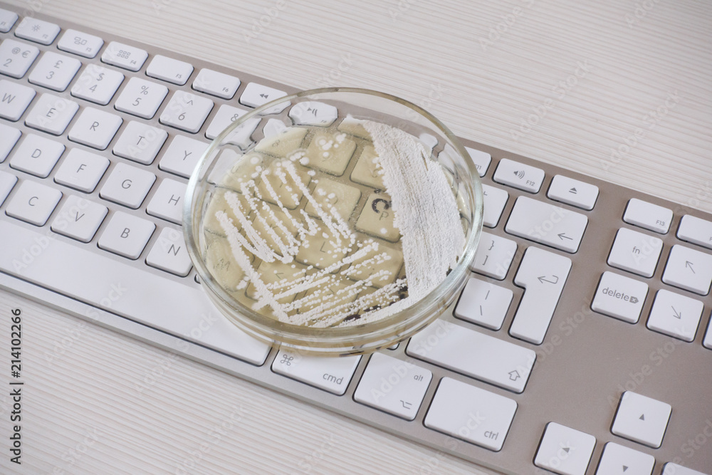 Bacteria that are on the keyboard. A petri dish with bacteria colonies ...