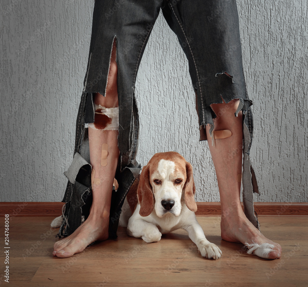 Beagle and his owner in torn pants and bitten feet. Stock Photo | Adobe ...
