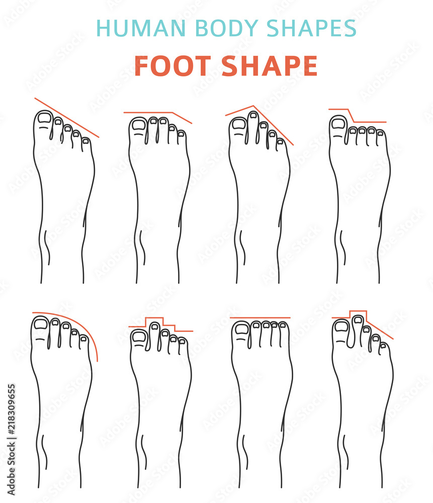 Human body shapes.Feet types icon set Stock Vector | Adobe Stock