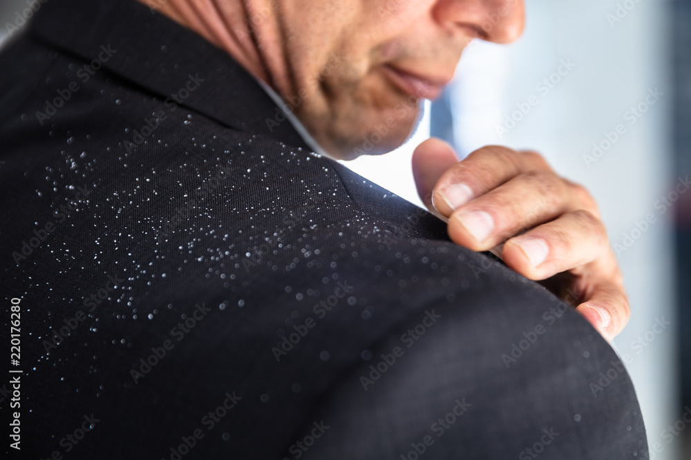 Businessman Brushing Off Fallen Dandruff On Shoulder Stock Photo ...