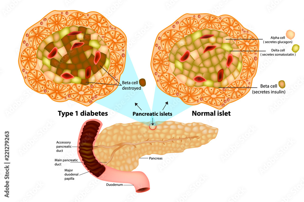 The pancreas has many islets that contain insulin-producing beta cells ...