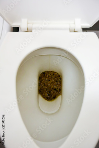Feces in public toilet, Users who forget to flush the toilet.Dirty ...