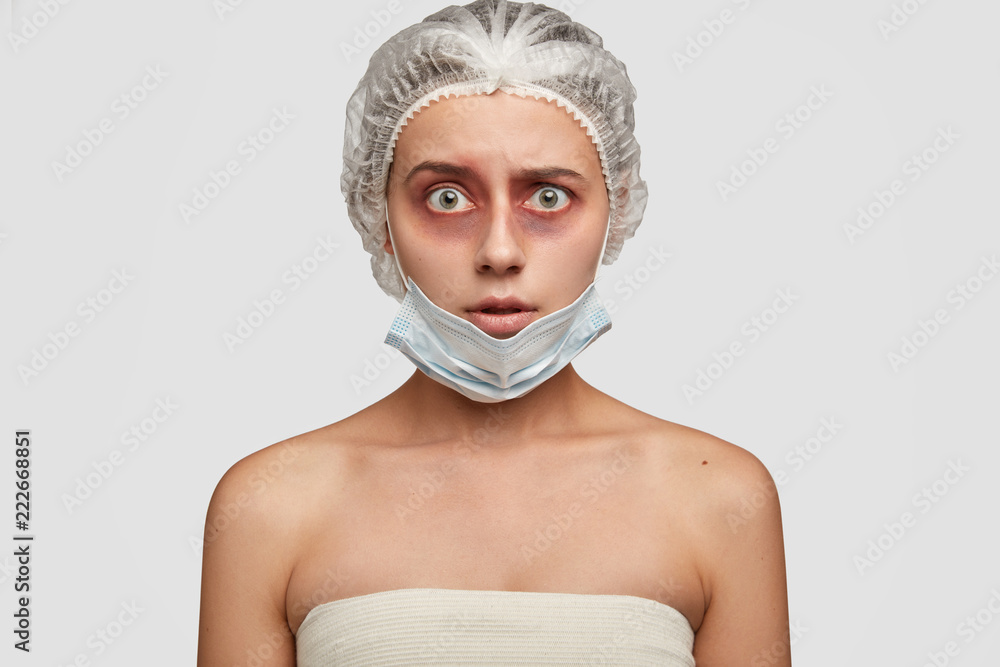 Stunned young woman being operated after concussion, stares at her face ...