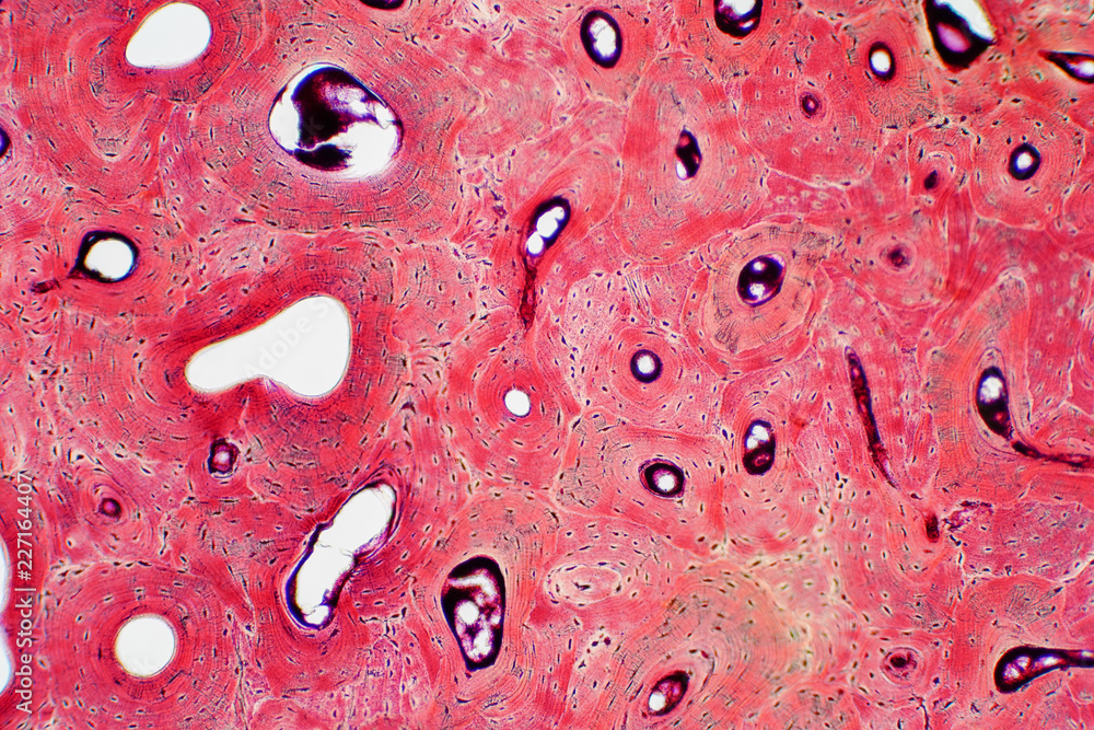 Histology of human compact bone tissue under microscope view for ...