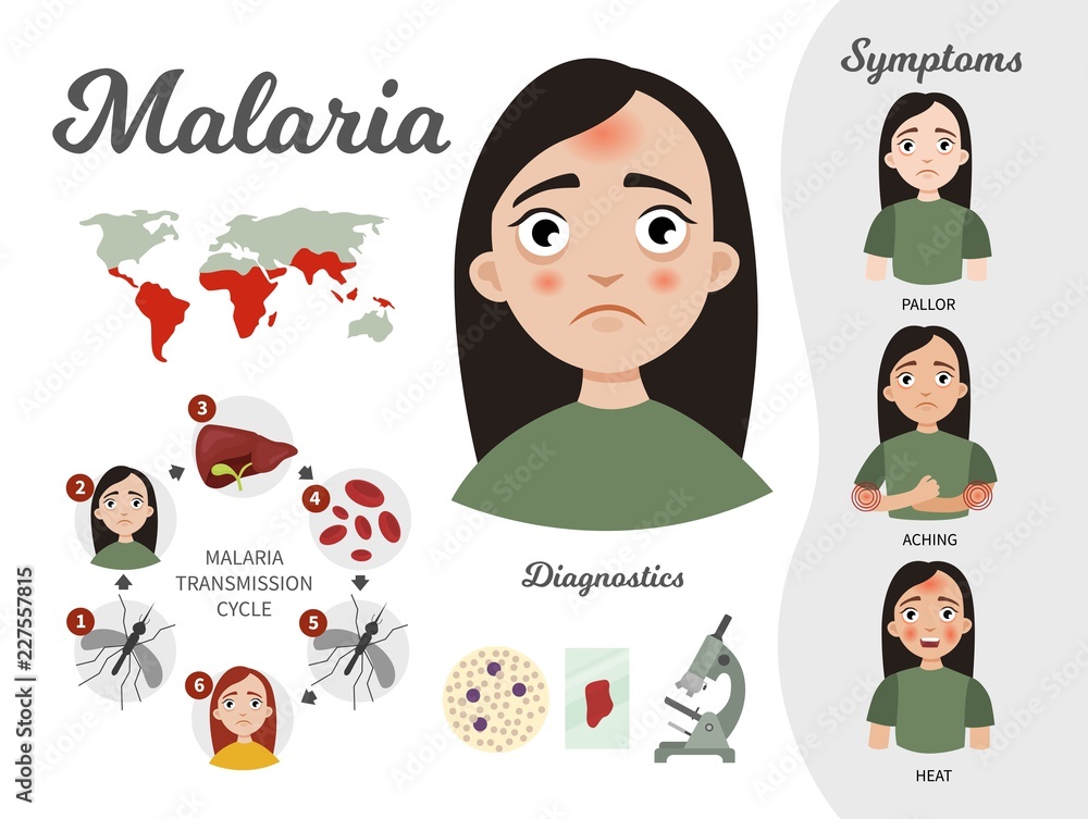 Infographics of malaria. Illustration of a cute girl. The development ...