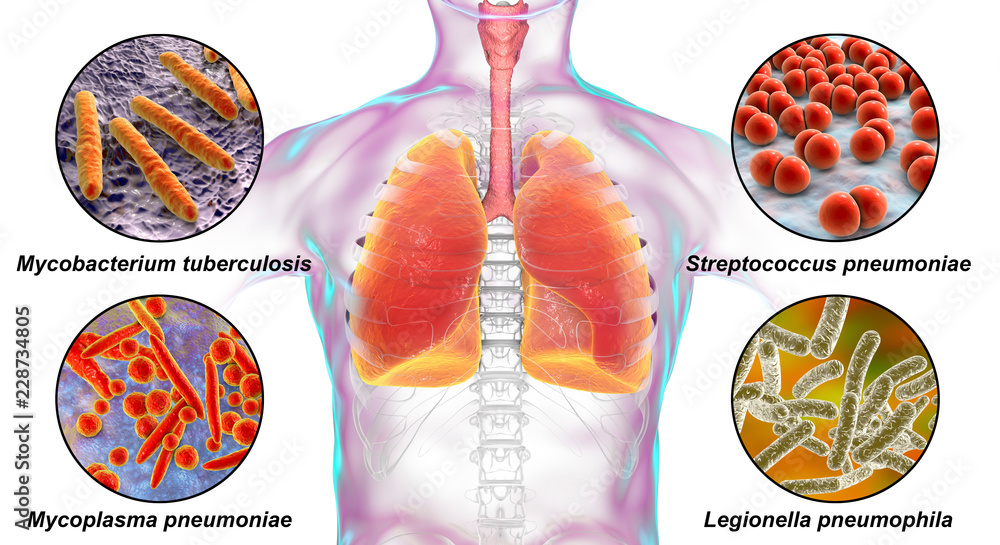 Human respiratory pathogens, 3D illustration. Mycobacterium ...