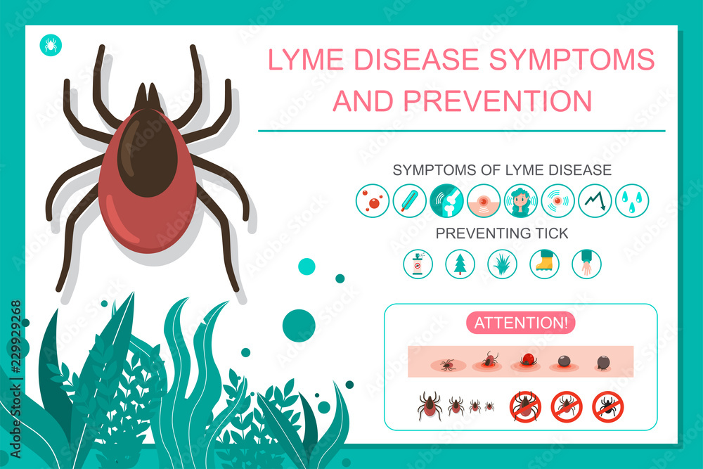Preventing tick bite and lyme disease symptoms. Vector cartoon medical infographic. Stock Vector ...