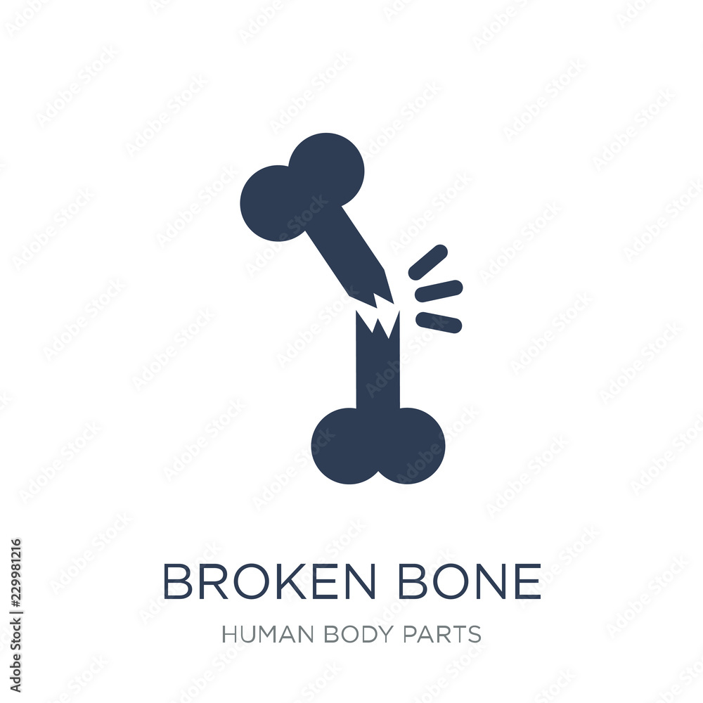 Broken bone icon. Trendy flat vector Broken bone icon on white ...