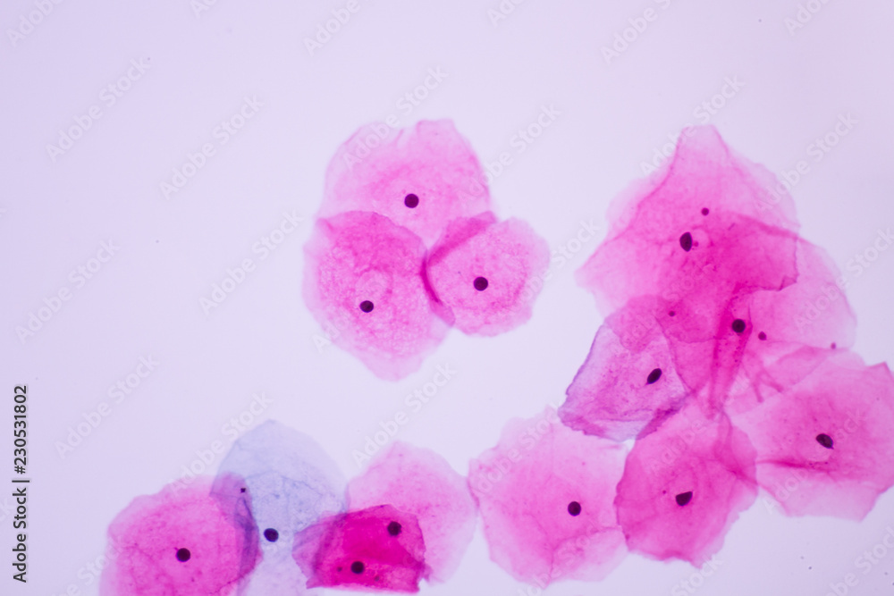 Normal squamous epithelial cells of cervical woman on white background ...