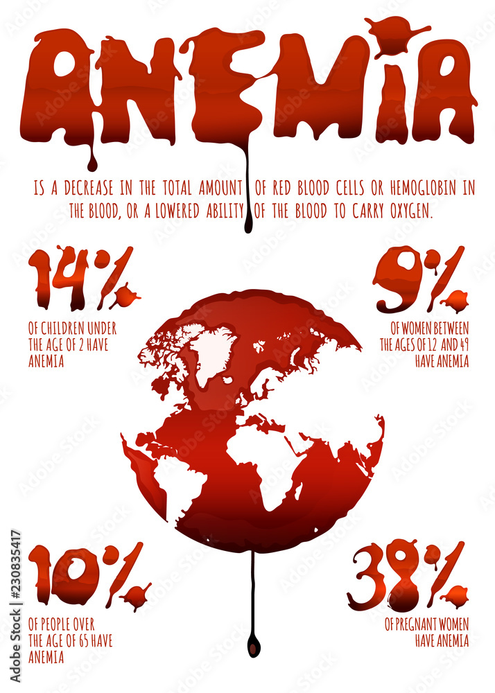 Anemia infographic poster Stock Vector | Adobe Stock
