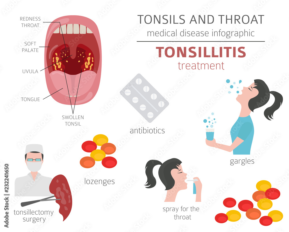 Tonsils and throat diseases. Tonsillitis symptoms, treatment icon set ...