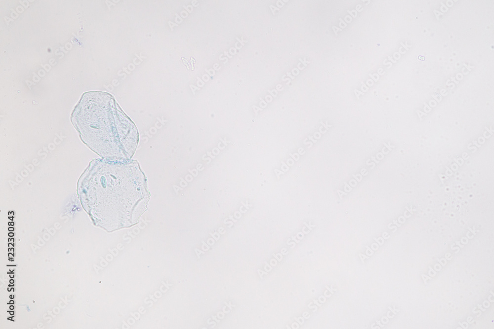 Characteristics of Squamous epithelial cell (Cell structure) of human ...