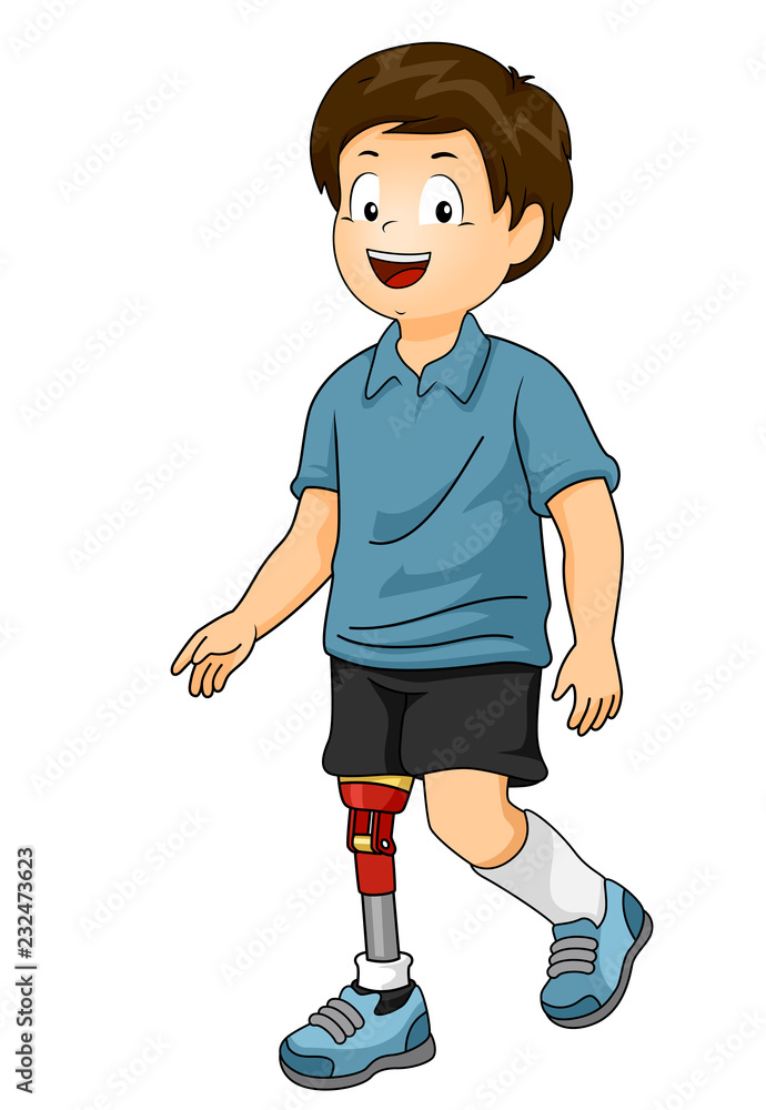 Kid Boy Prosthetic Leg Illustration Stock Vector | Adobe Stock
