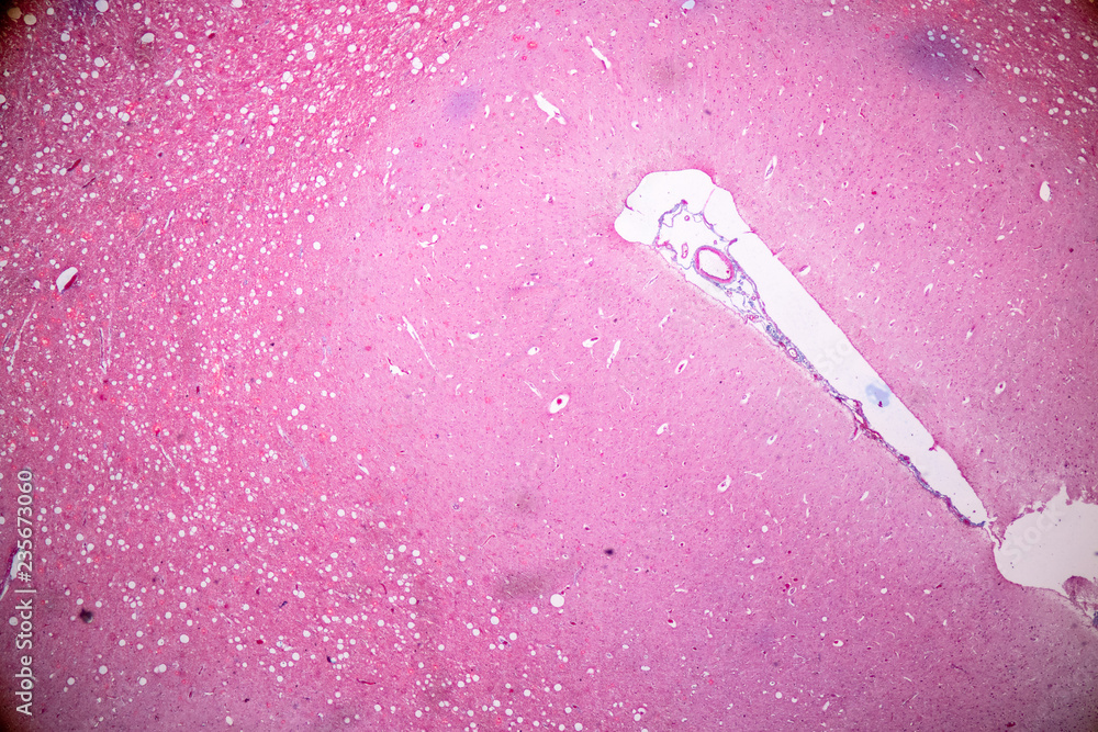 Cross section of the Cerebellum and Nerve human under the microscope ...