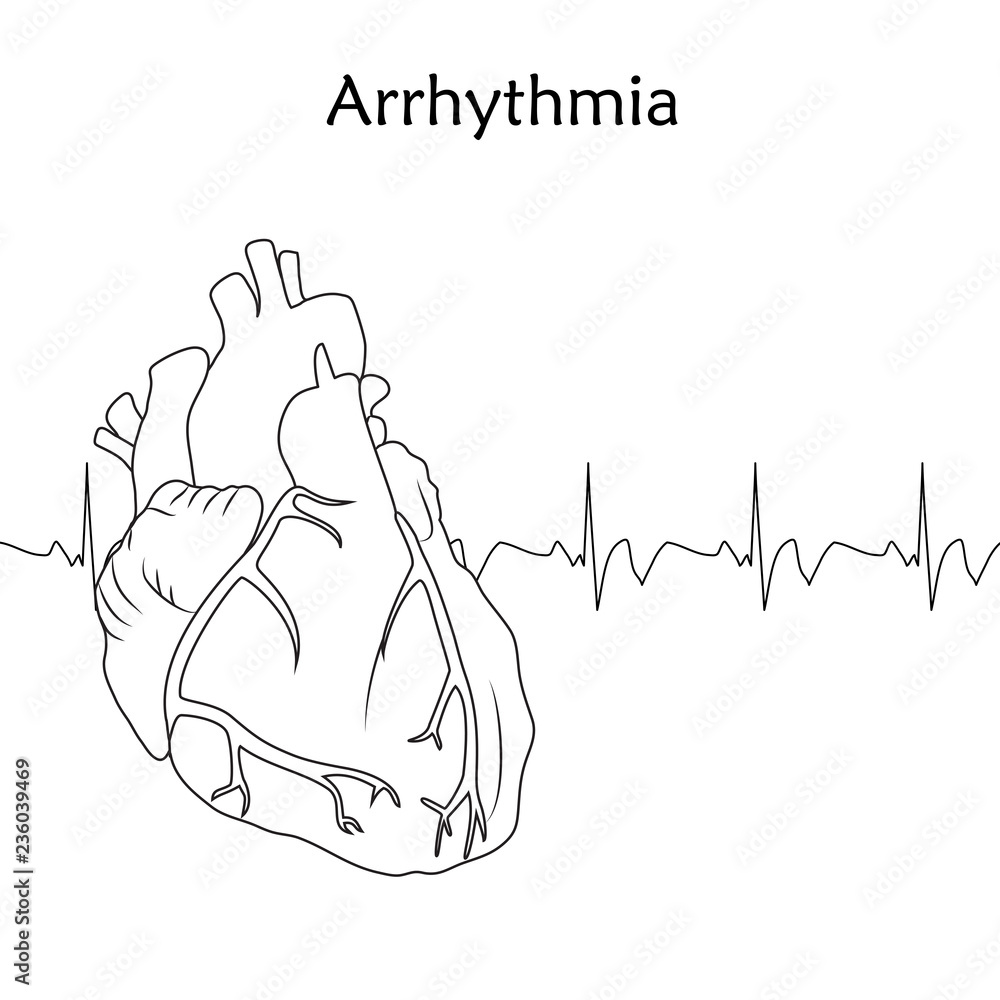 Human heart. Arrhythmia. Anatomy flat illustration. Outline image ...
