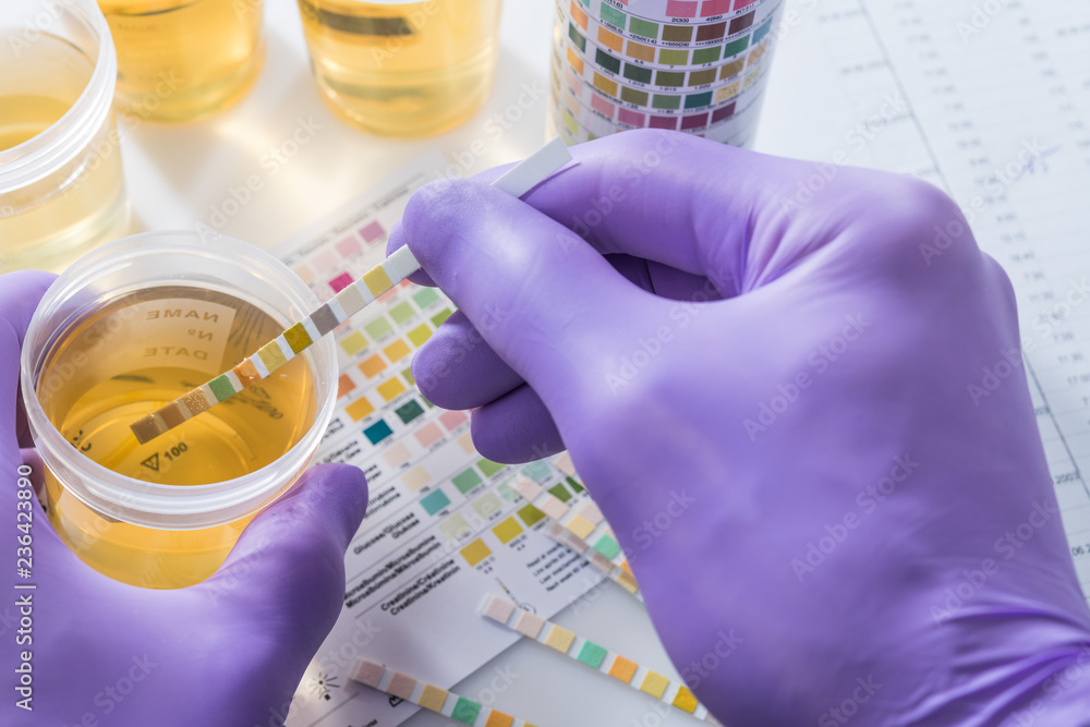 urine test strips in purple gloves Stock Photo | Adobe Stock