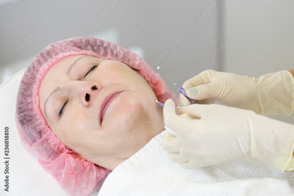 Close-up of procedure for face lifting PDO Suture operation, face ...