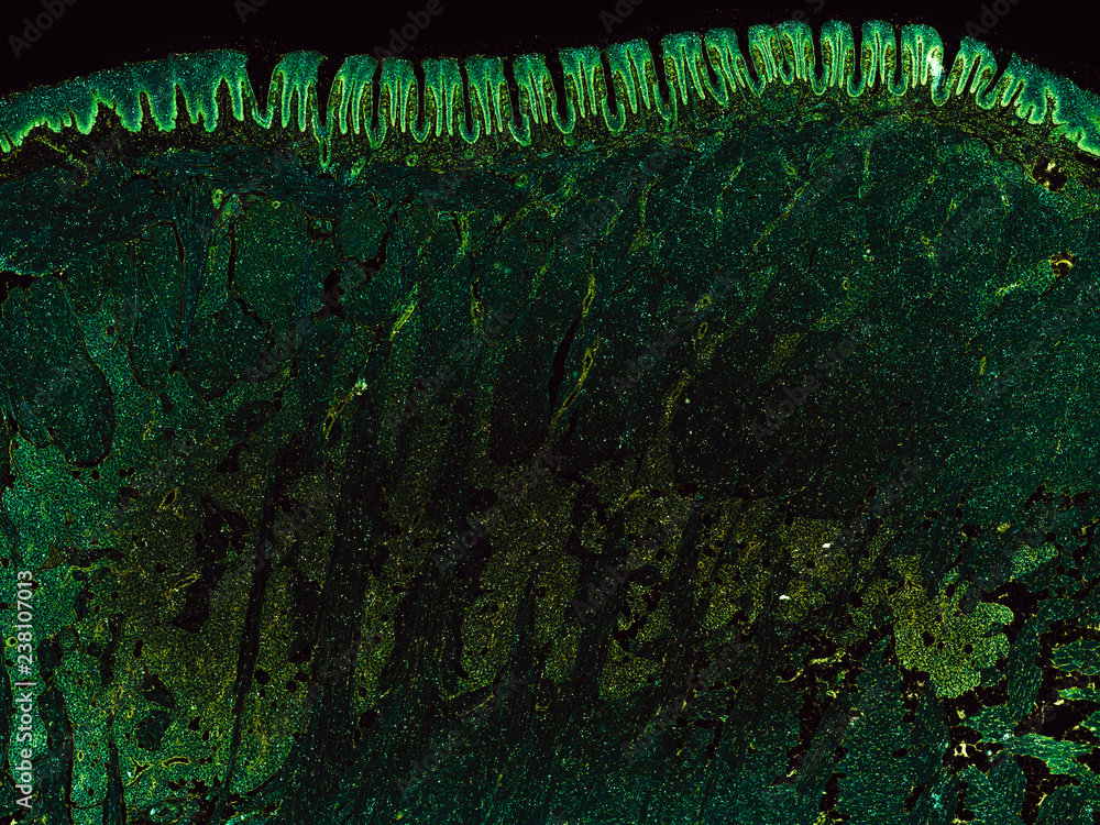 taste buds - cross section cut under the microscope – microscopic view ...