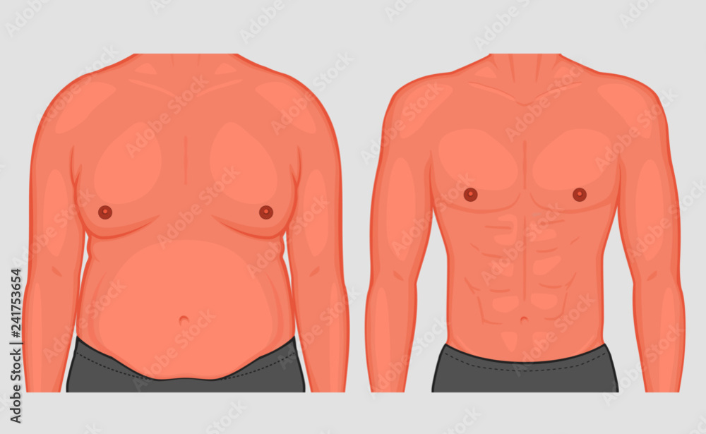 Vector illustration torso of a male before and after weight loss and ...