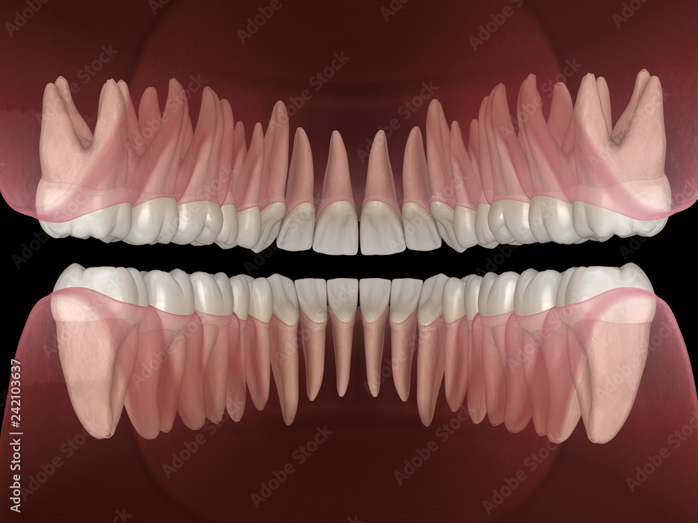 Morphology of mandibular and maxillary human gum and teeth. Medically ...
